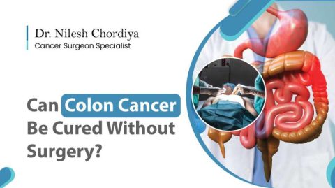 Can Colon Cancer Be Cured Without Surgery? | Dr Nilesh Chordiya